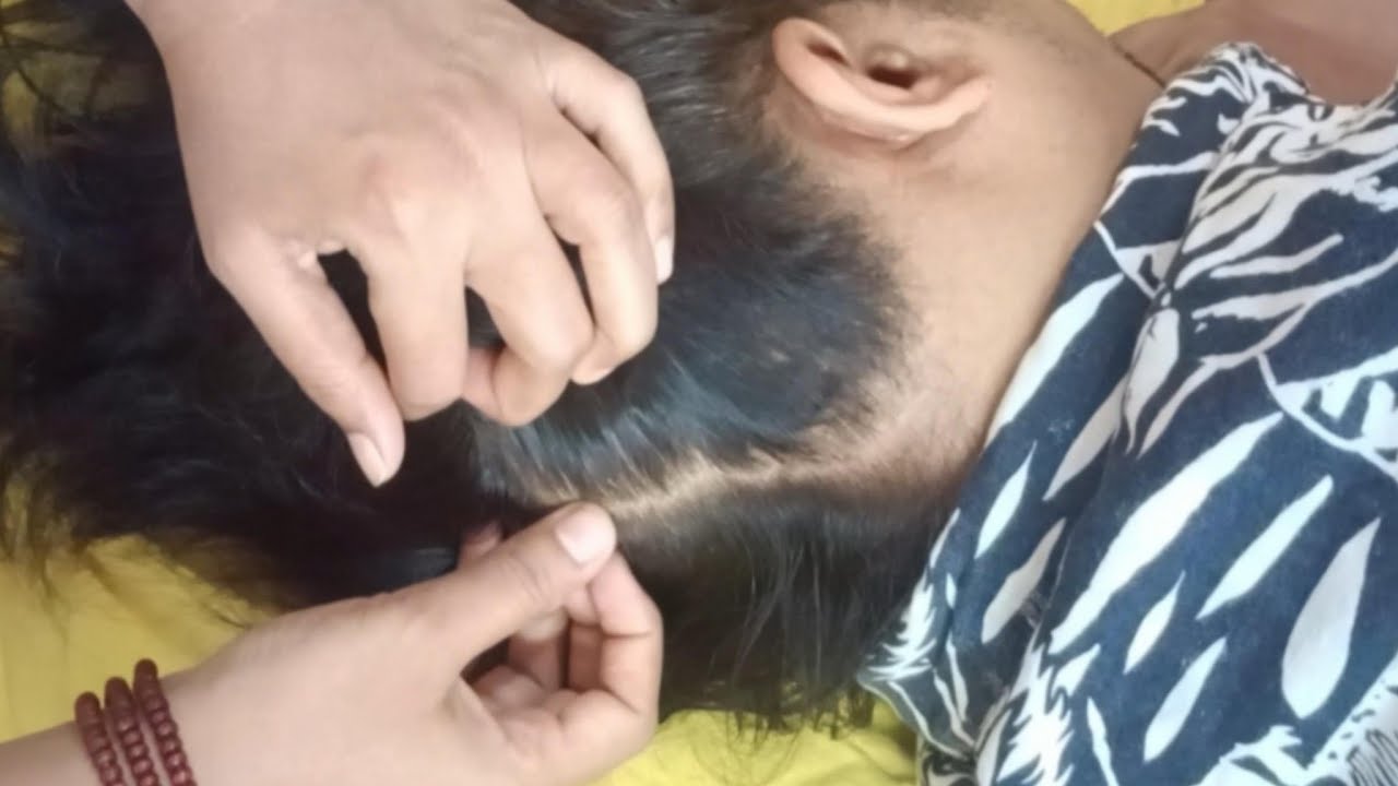 Scalp Check ASMR (Tapping, Scratching, Brushing Sounds) - YouTube