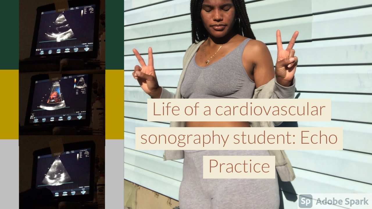 Life Of A Cardiovascular Sonography Student: Echo Practice - YouTube