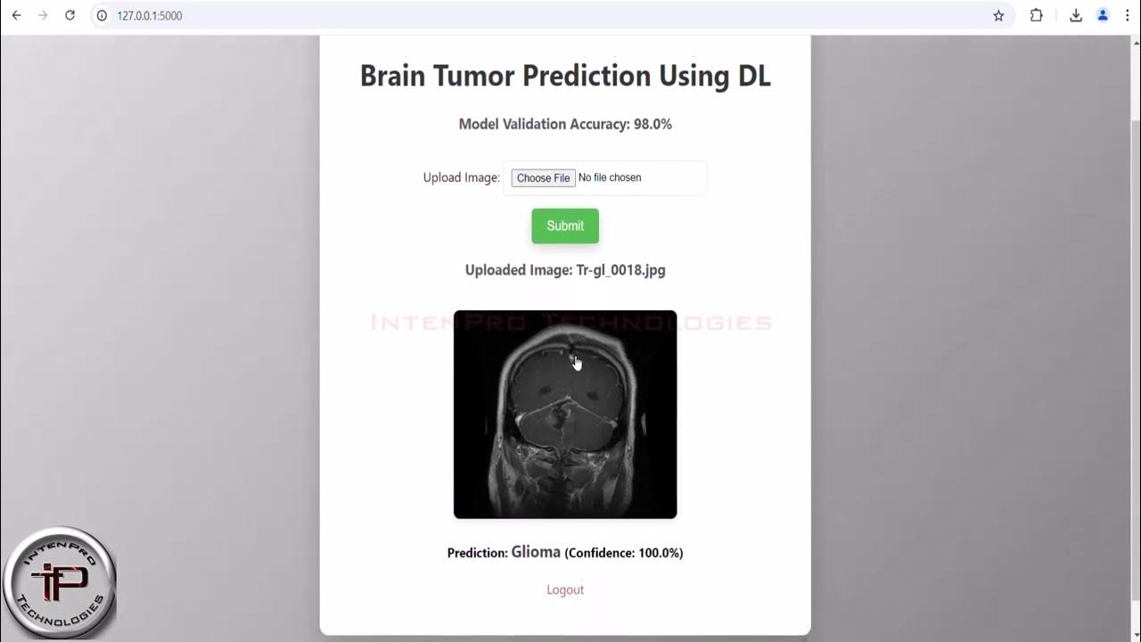 Final Year Project - Brain Tumor Classification Using Deep Learning PYTHON - IntenPro ...