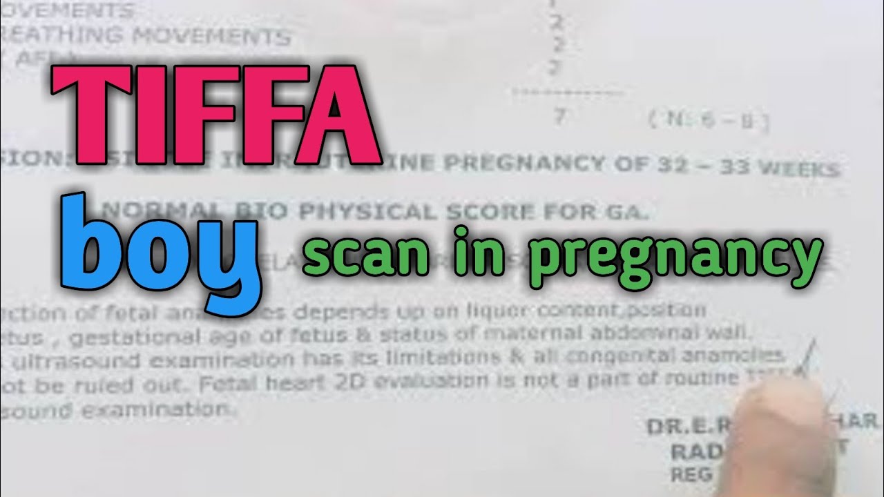 Tiffa Scan Report For Baby Boy 32 Weeks baby Boy Scan 32 Weeks baby tiffa-scan-report-for-baby-boy-32-weeks-baby-boy-scan-32-weeks-baby