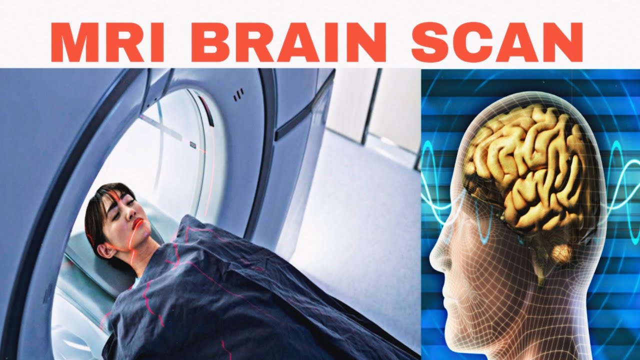 MRI BRAIN SCAN, GE - YouTube