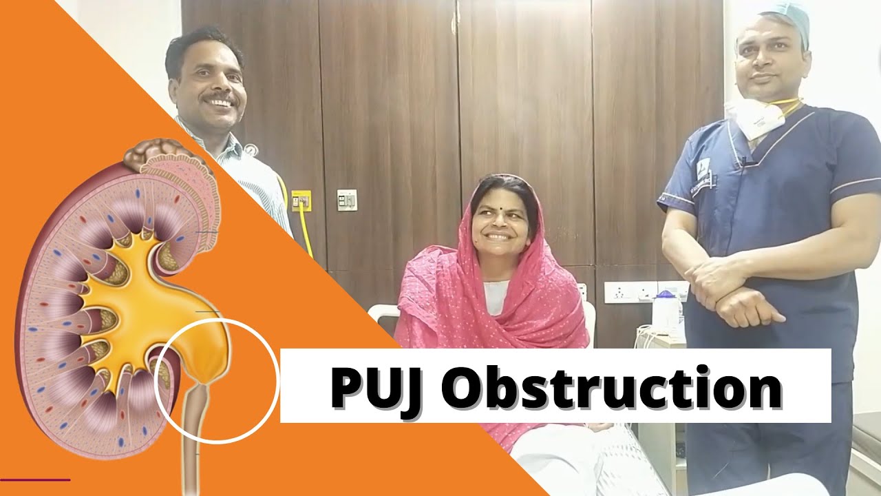 Successful Pyeloplasty done to correct PUJ obstruction | repair ureter ...