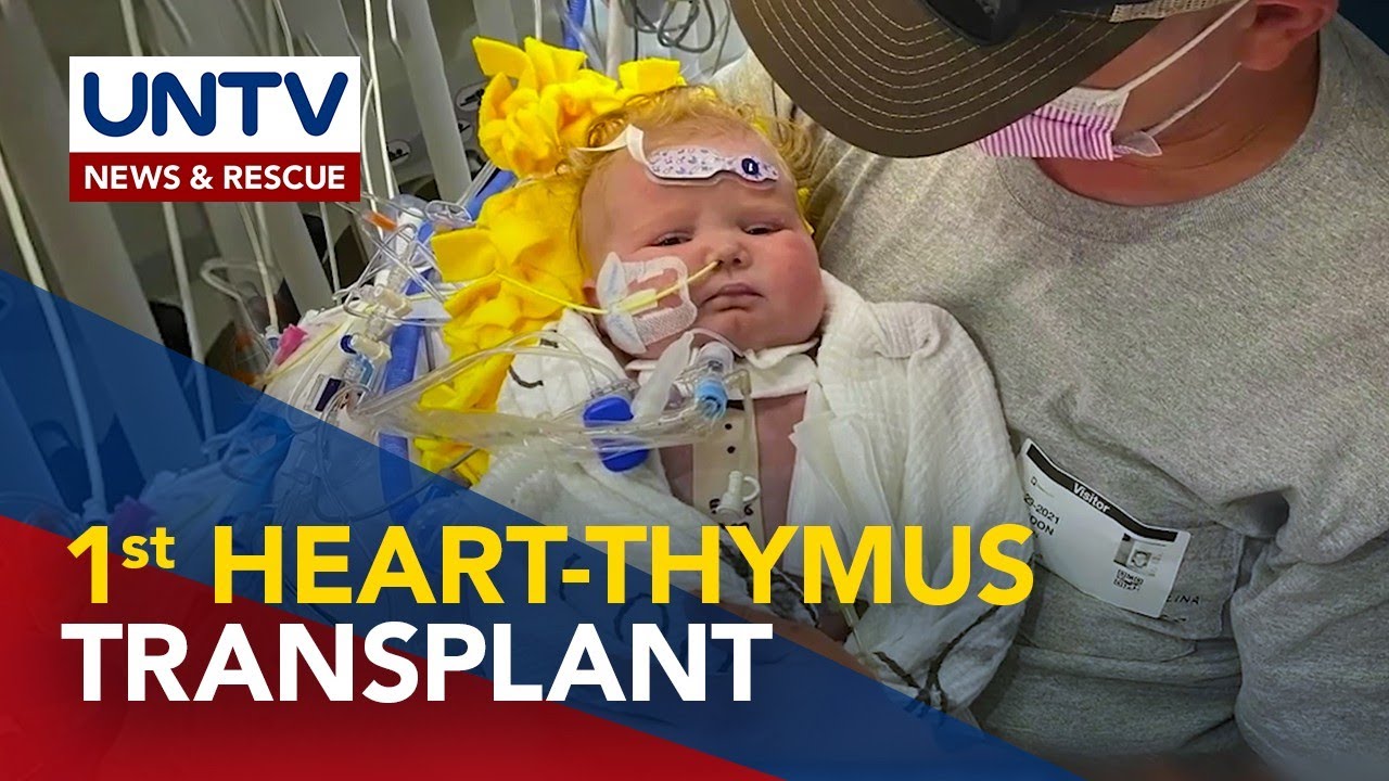First heart-thymus transplant sa mundo, tagumpay - YouTube