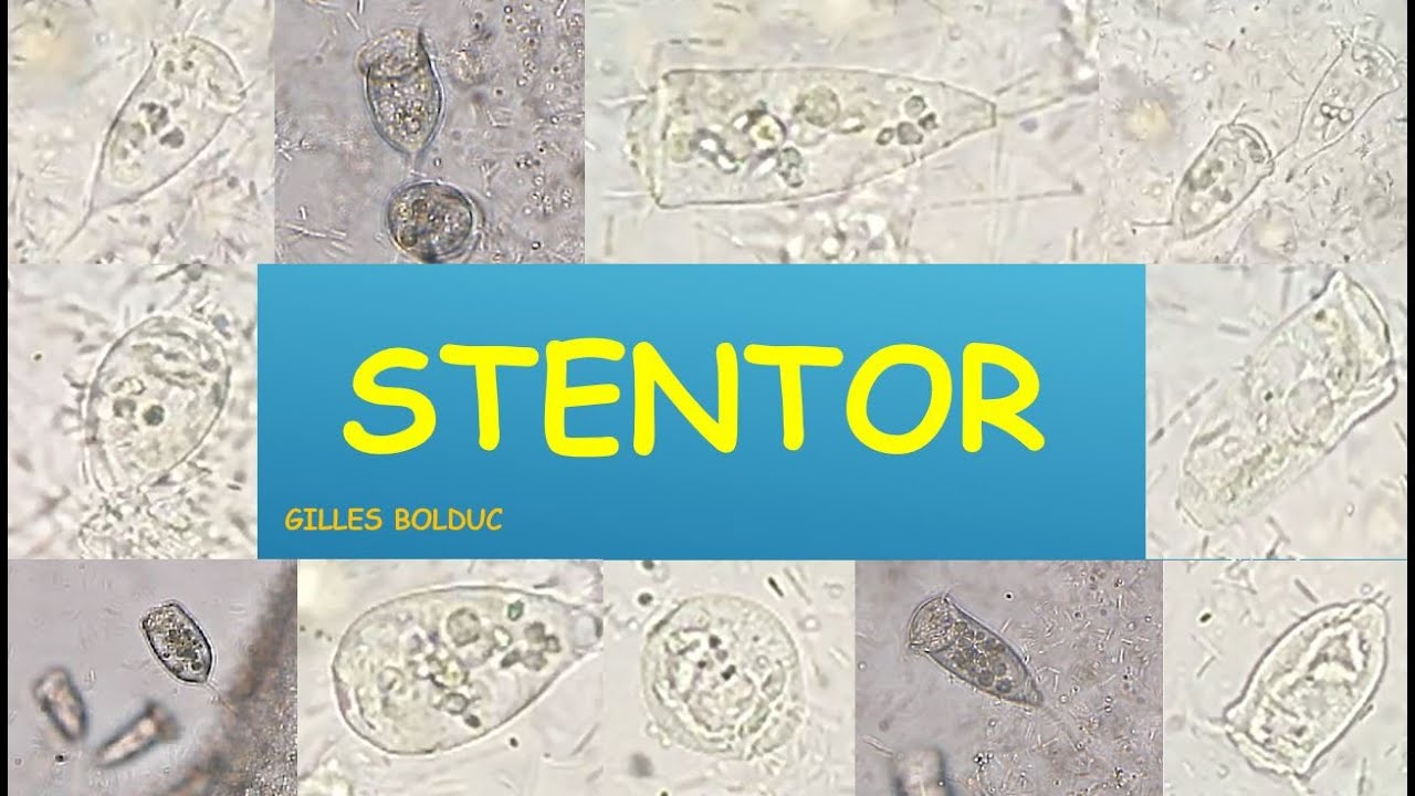 Stentor (Trumpet protists) - YouTube