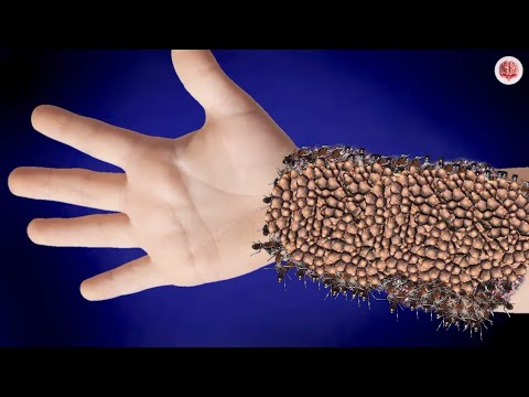 ASMR Treatment from Maggots Infected Hand| ASMR 2d Deep Cleaning ...
