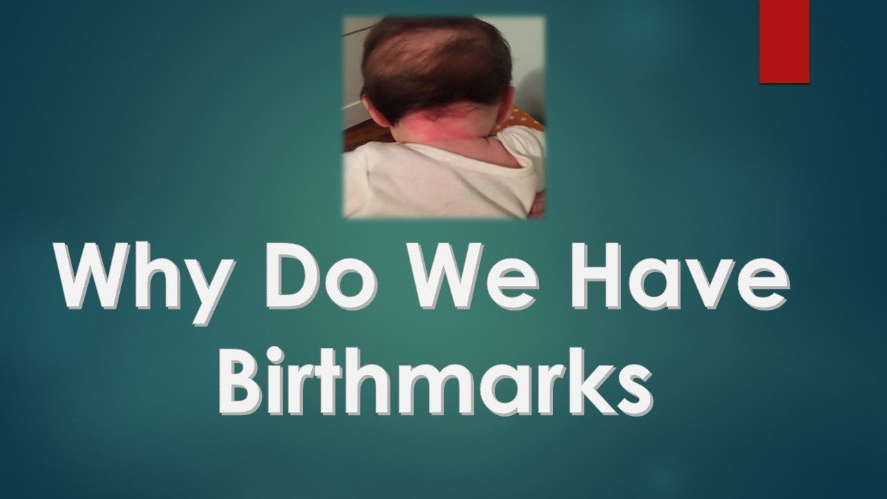 Why Do We Have Birthmarks Hindi Youtube