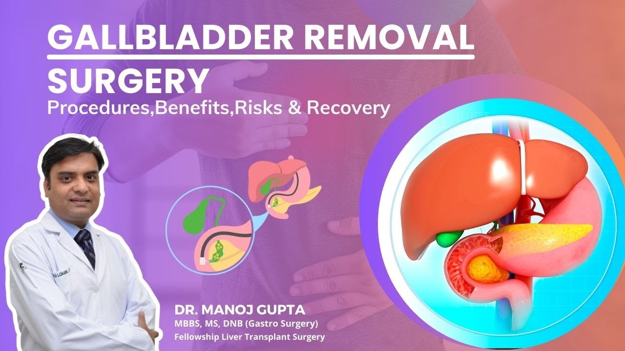 Gallbladder Removal Surgery| Procedures,Benefits,Risks & Recovery |Dr ...