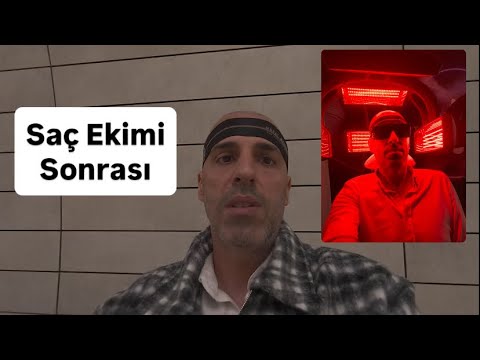 Saç Ekimi Sonrası 1. Gün - Adana’ya Dönüyorum