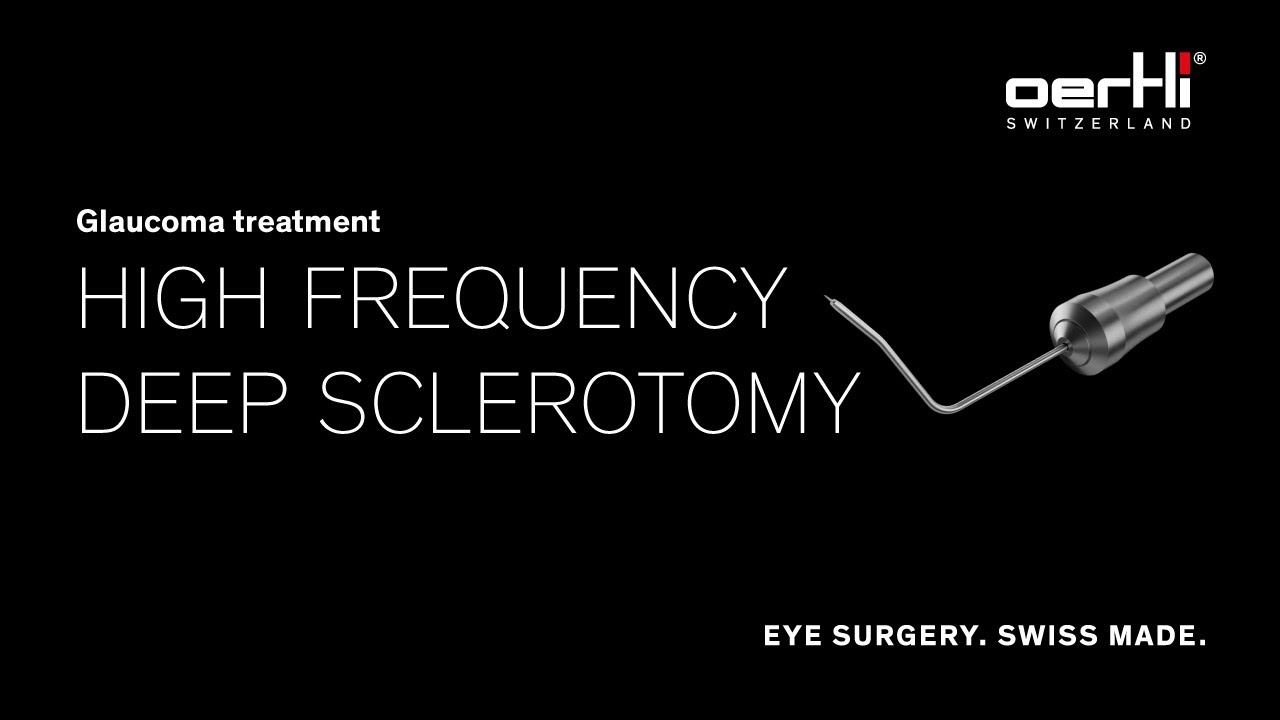 Spotlight: HFDS (High Frequency Deep Sclerotomy) | Glaucoma treatment ...