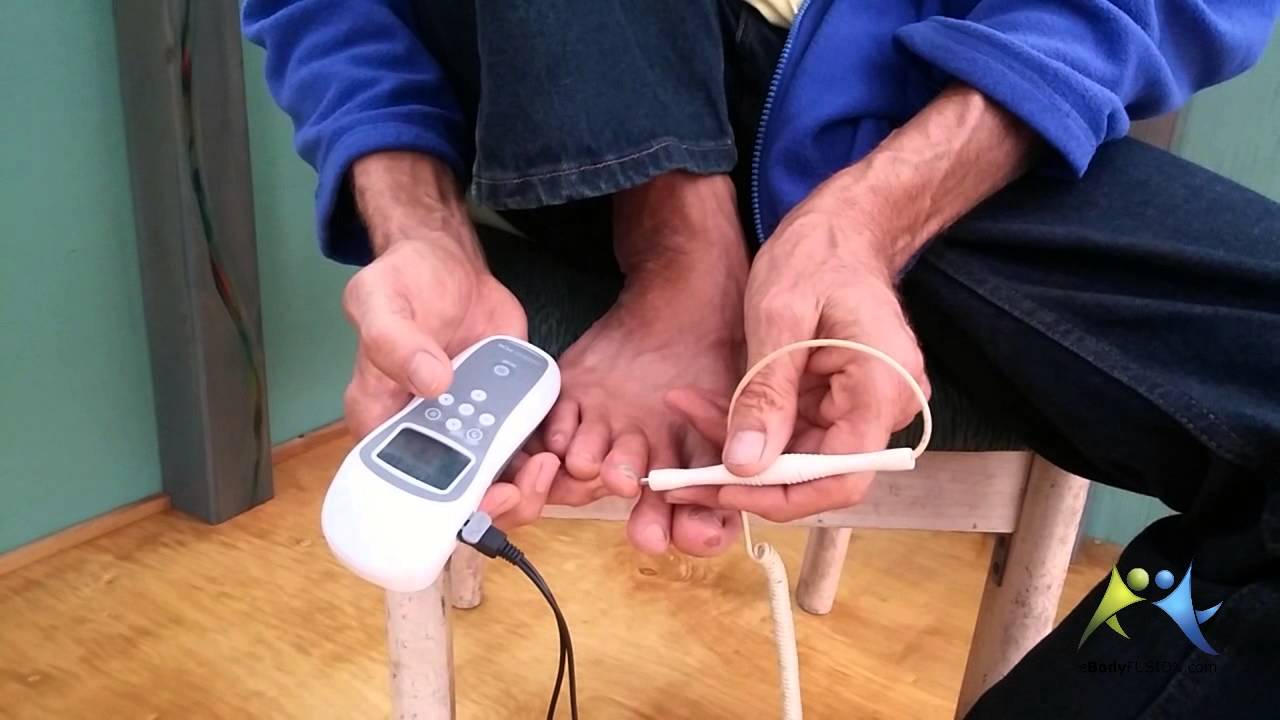 DENAS PCM 6 for Squashed Toe and Injuries Plus DENAS PCM 6 Acupuncture ...