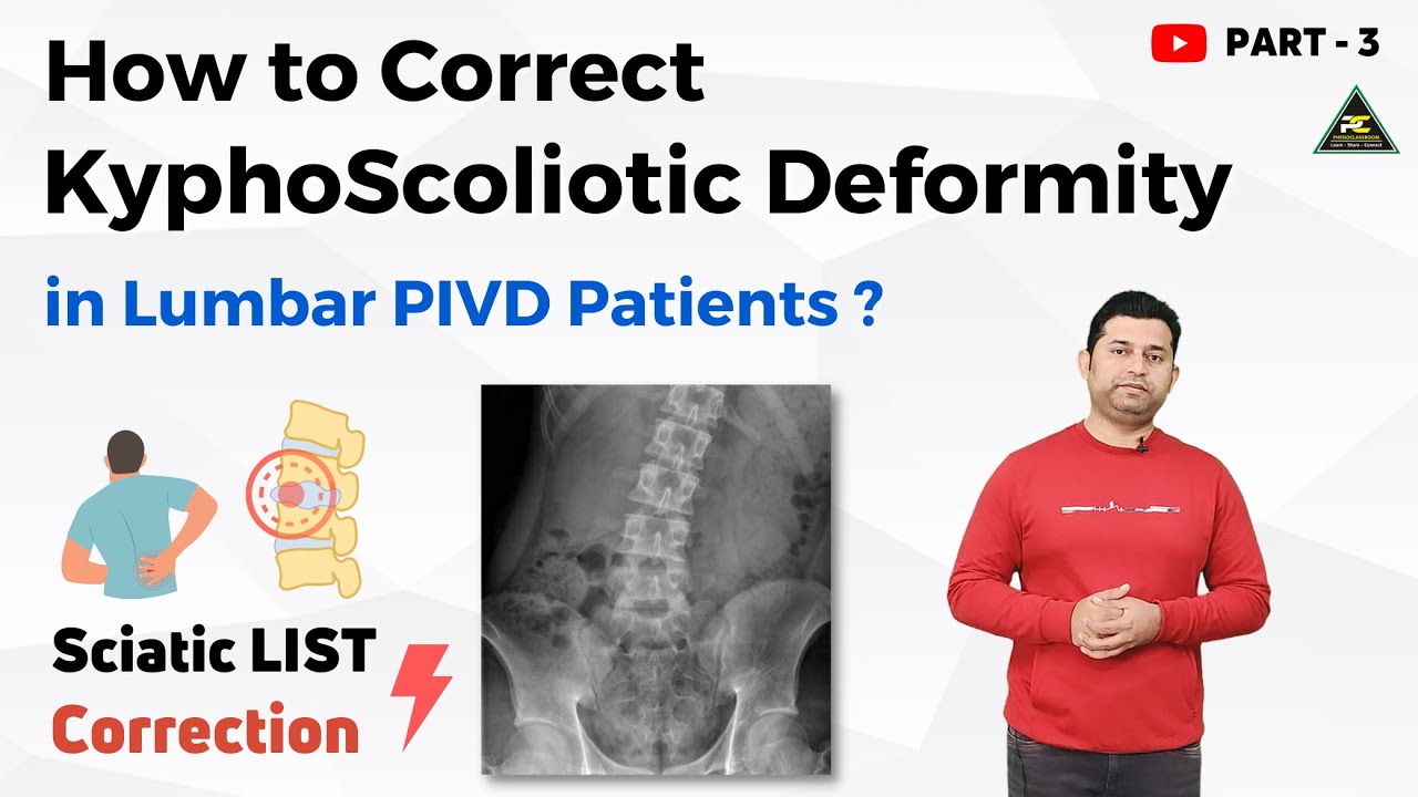 PHYSIOTHERAPY TREATMENT FOR SCIATIC LIST / SCOLIOSIS IN DISC PROLAPSE ...