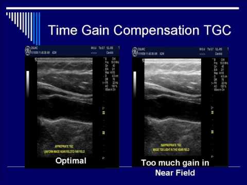 Physics of Ultrasound: Pulse Echo US - Segment #3 - YouTube