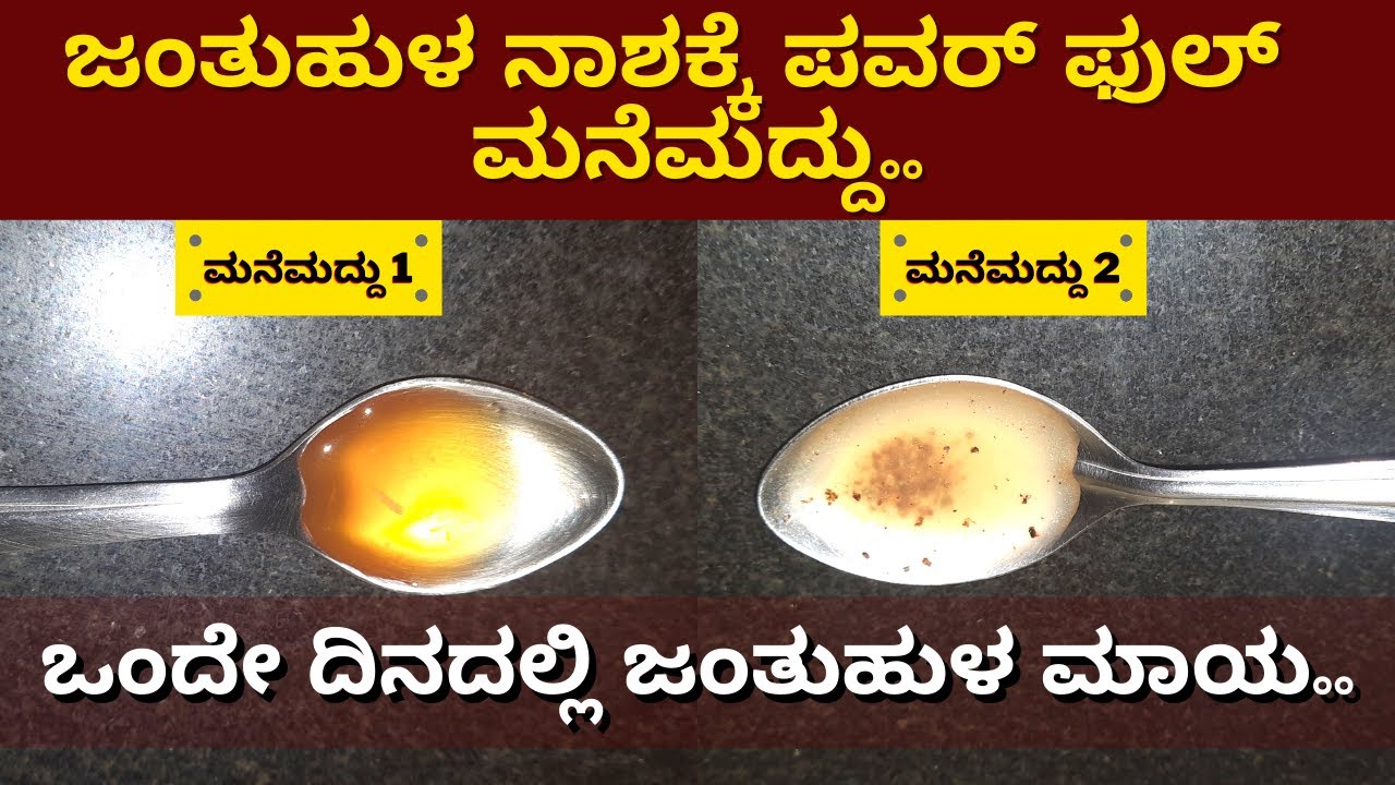 ಜಂತುಹುಳ ನಾಶಕ್ಕೆ ಪವರ್ ಫುಲ್ ಮನೆಮದ್ದು ಒಂದೇ ದಿನದಲ್ಲಿ ಜಂತುಹುಳ ಮಾಯ Home