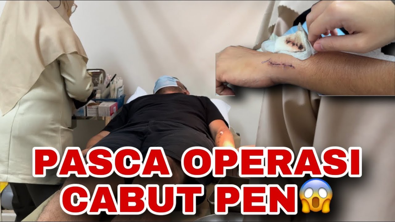 SEMINGGU PASCA OPERASI CABUT PEN - YouTube