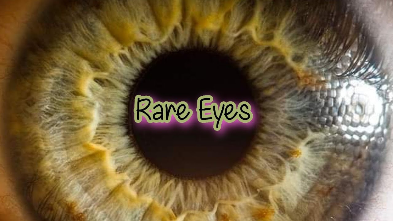 Most beautiful rare eyes around the world | rare eyes colors | world's ...