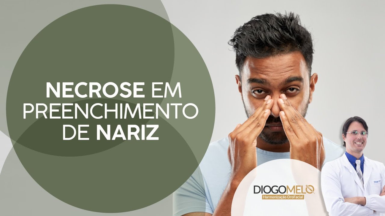 Sobre o alto índice de necrose em Preenchimento de Nariz - YouTube