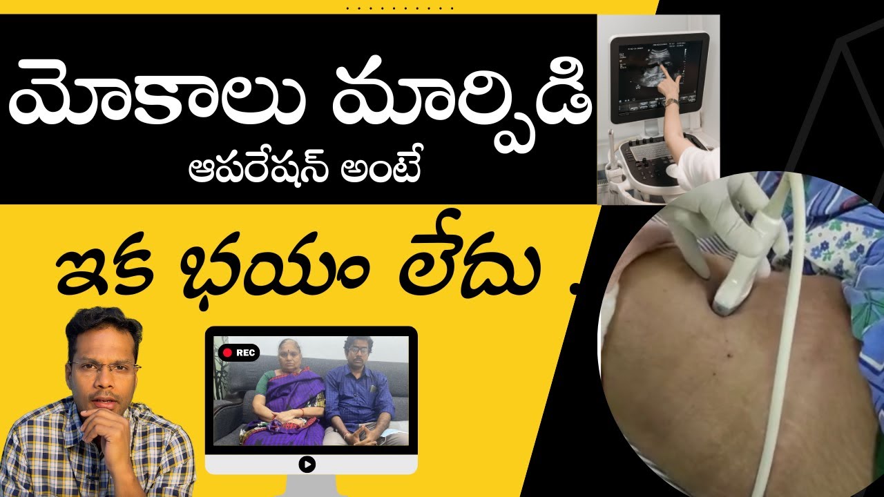 Fast track knee replacement | Pt Testimonial | Nerve block for pain ...