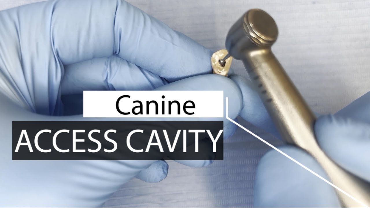 🔵Maxillary and Mandibular Canine - Endodontic Access Cavity Preparation ...