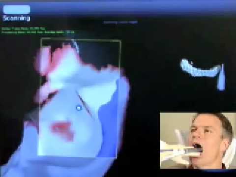 Lava Chairside Oral Scanner C.O.S. - YouTube