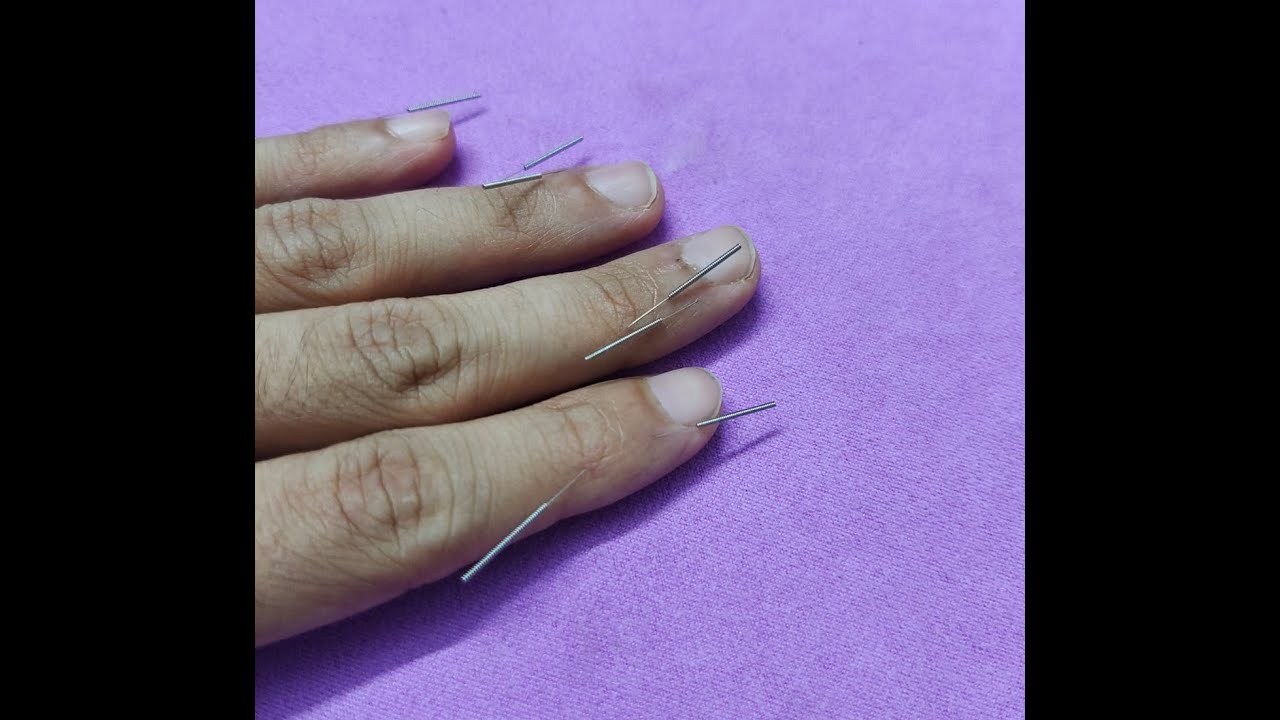 SAMPLE SIX - KI ACUPUNCTURE DEMO Clip on self - YouTube