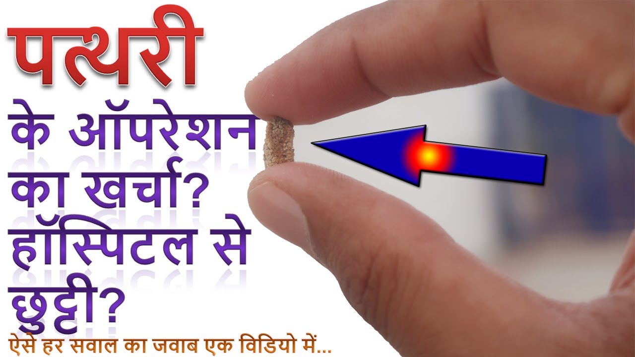 pathari ke operation ka kharach aur kitne din me chhuti mil jati hai ...