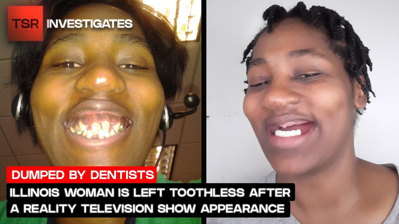 How a Reality Show Left This Illinois Woman Toothless | TSR ...