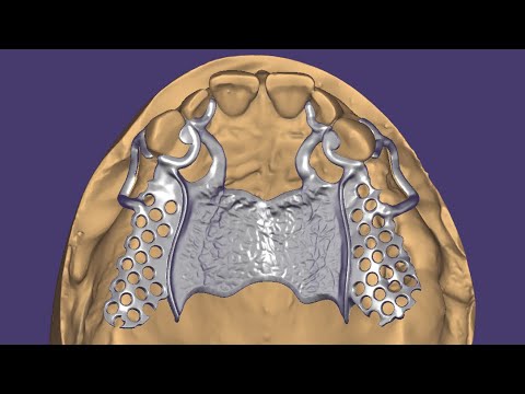 Châssis maxillaire - YouTube