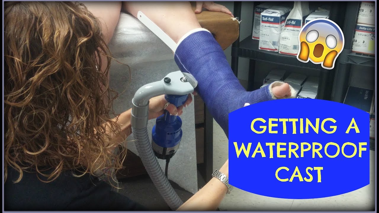 (NURSE CUTTING THE CAST OFF) GETTING A WATERPROOF CAST - BROKEN FOOT ...