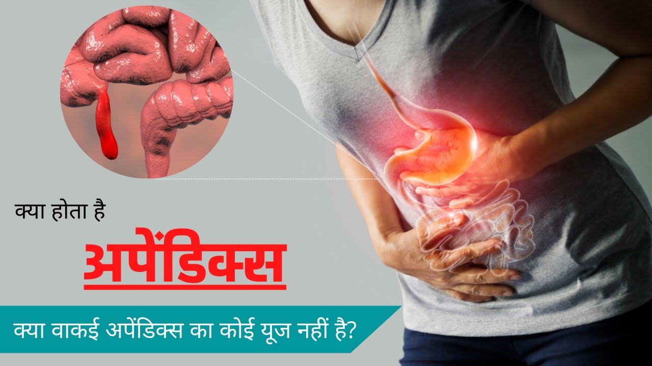 Appendicitis: Causes, Symptoms, Location, Function, Surgery, Treatments & Facts in Hindi - YouTube