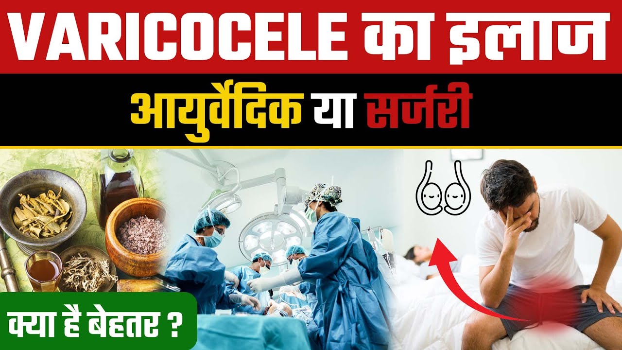 Varicocele का इलाज आयुर्वेदिक या सर्जरी क्या है बेहतर Varicocele