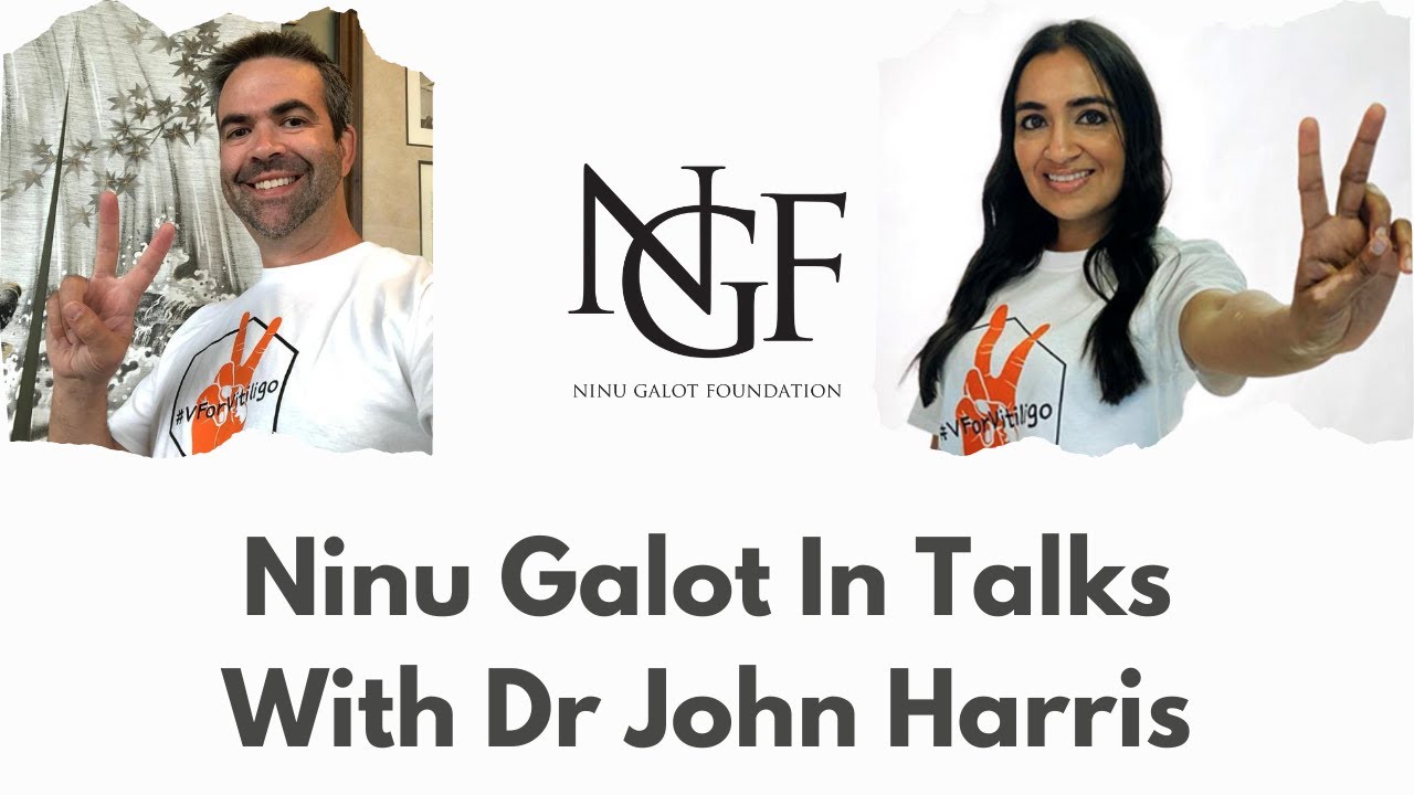 Ninu Galot In Talks With Dr John Harris About Vitiligo - YouTube