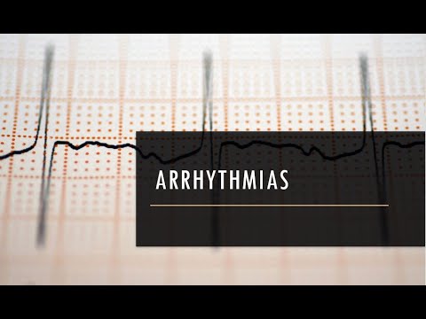Arrhythmias - YouTube