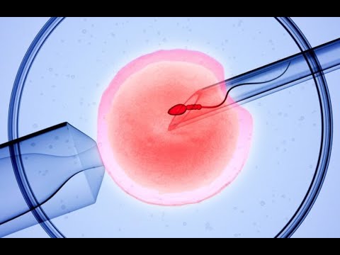 In vitro fertilization (IVF): Procedure & How It Works - YouTube