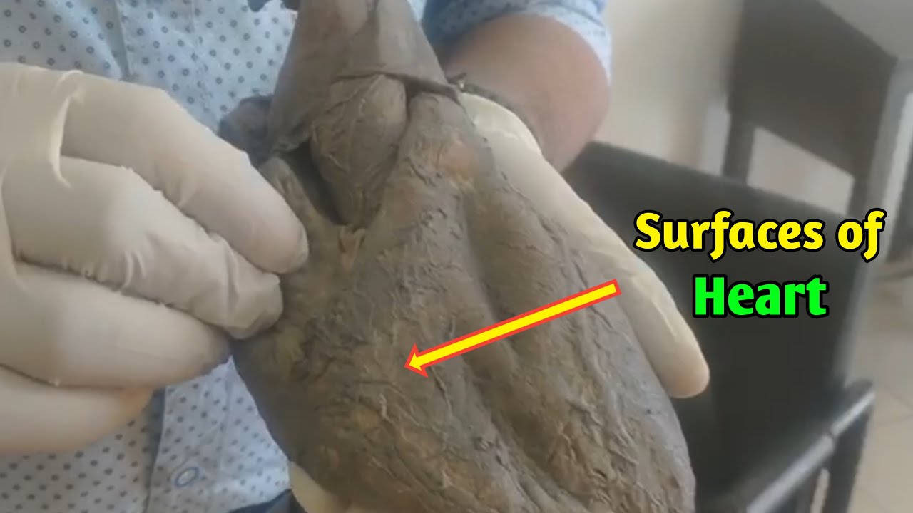 Surfaces and Borders of the heart anatomy | heart borders | heart ...