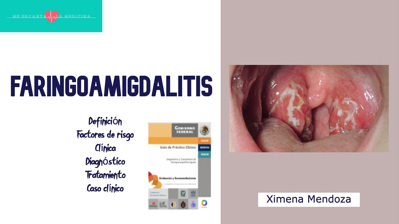 Faringitis Bacteriana: Síntomas Y Tratamiento – VSMNK