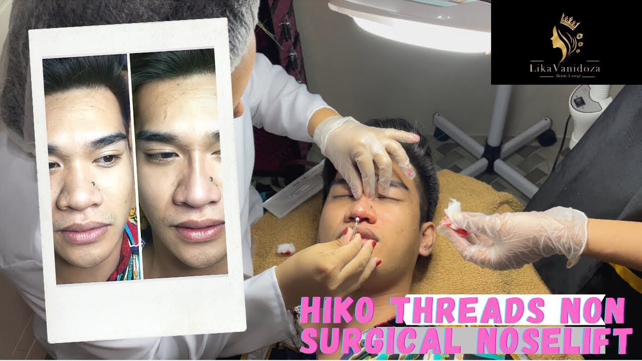 Hiko Threads Non-Surgical Noselift | Albert Flores - YouTube