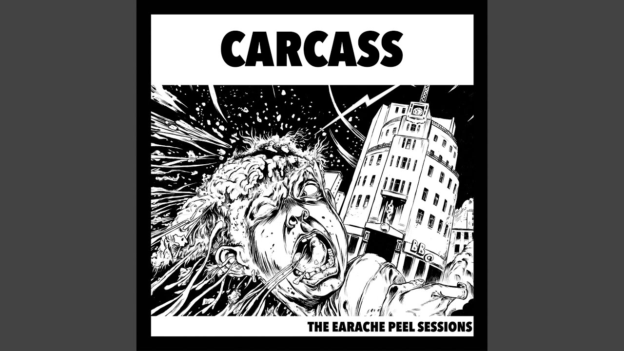 Crepitating Bowel Erosion - YouTube