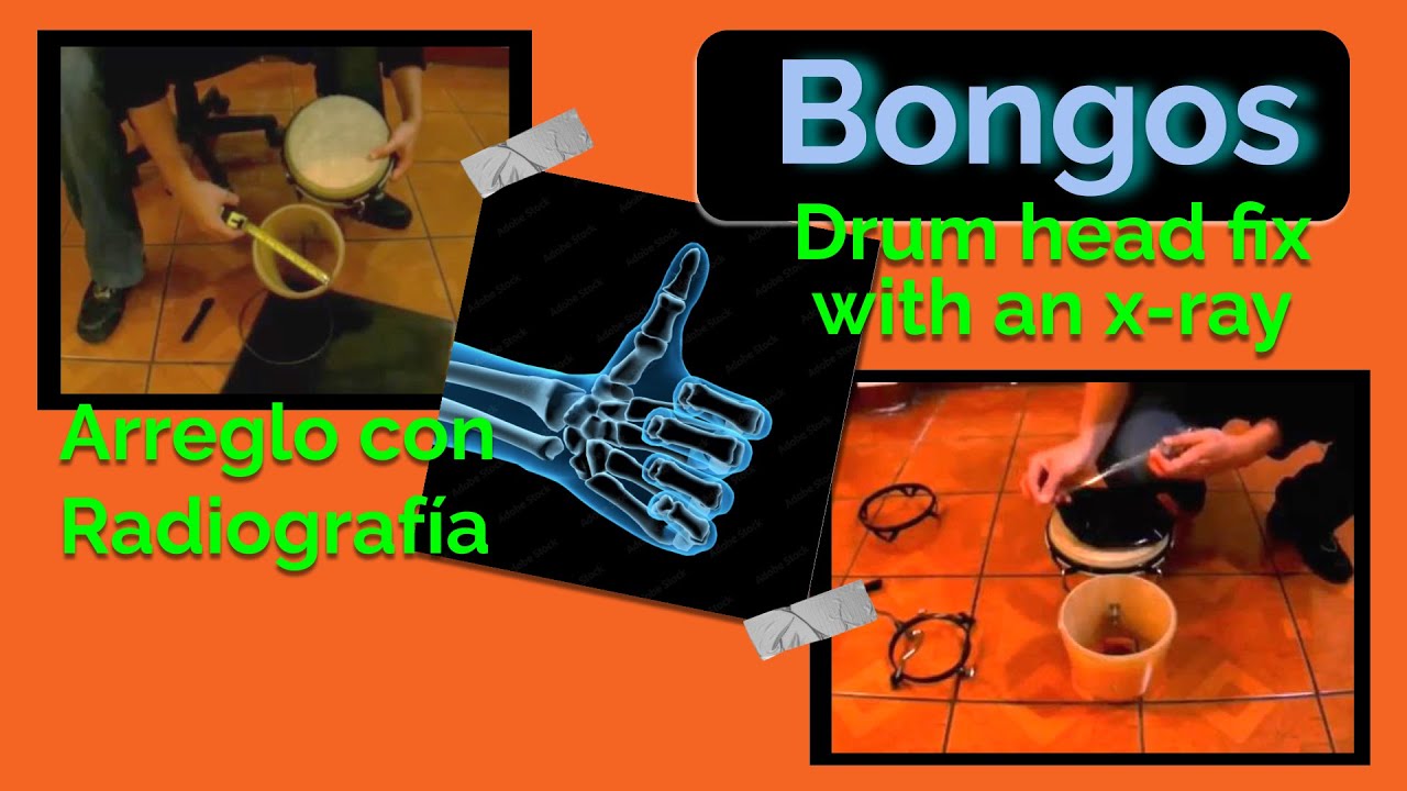 Bongo Cambio de Parche con film de rayos X - radiografia - YouTube