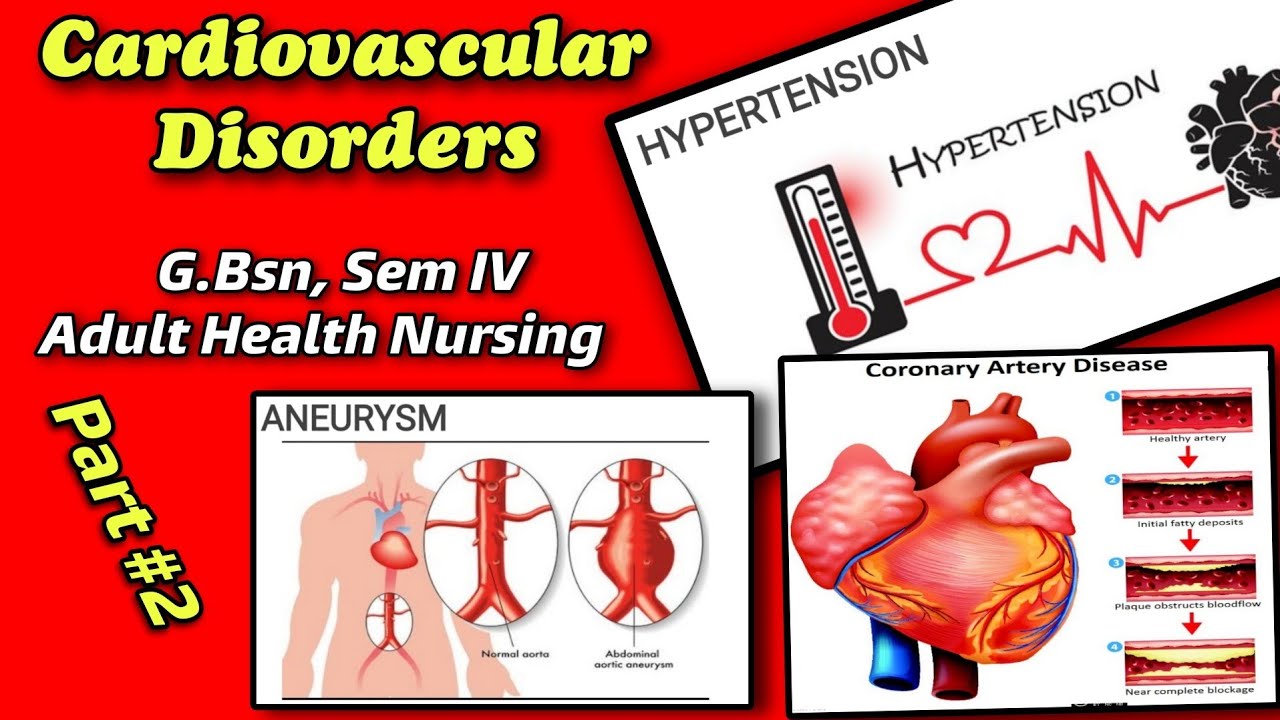 Cardiovascular Disorders | Aneurysm, Coronary artery disease ...