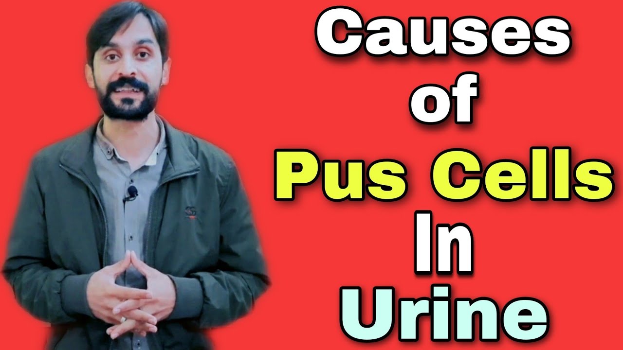 Causes of Pus Cells in Urine - YouTube