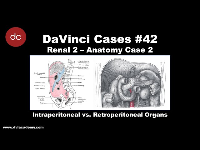 Intraperitoneal
