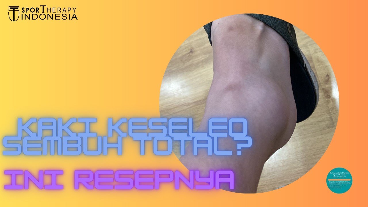 Terapi Ankle Keseleo - (Dahsyat) How to Fix Ankle Sprain - Bimbimjosh ...