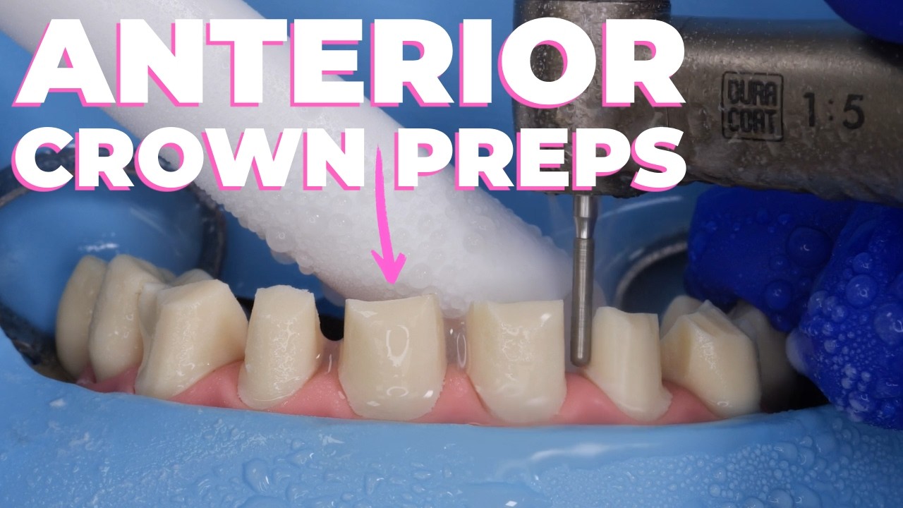 How To: Anterior Crown Preps with Dr. Lincoln Harris - YouTube