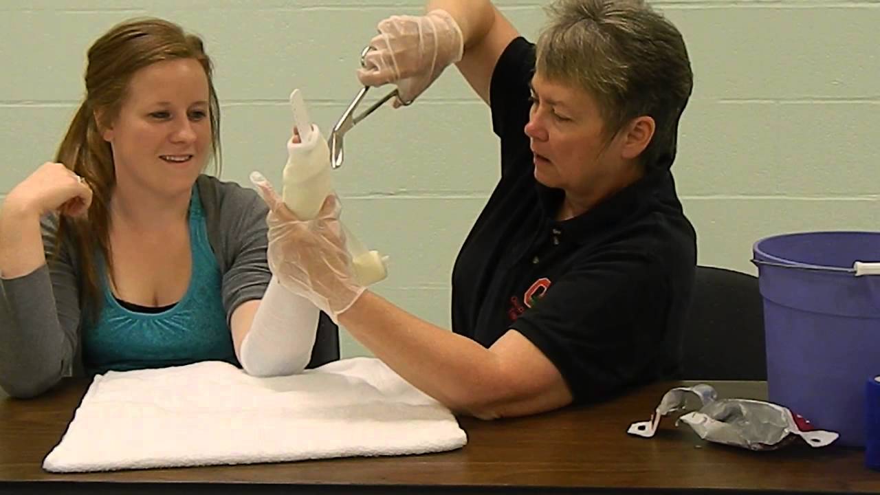 Demo: Casting for UE Spasticity - YouTube