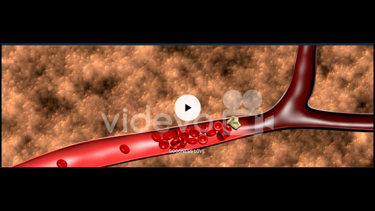 Thrombosis animation #biology #study - YouTube