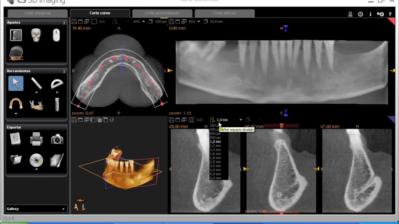 Tutorial CS 3D imaging software 04 Carestream Entornos de trabajo ...