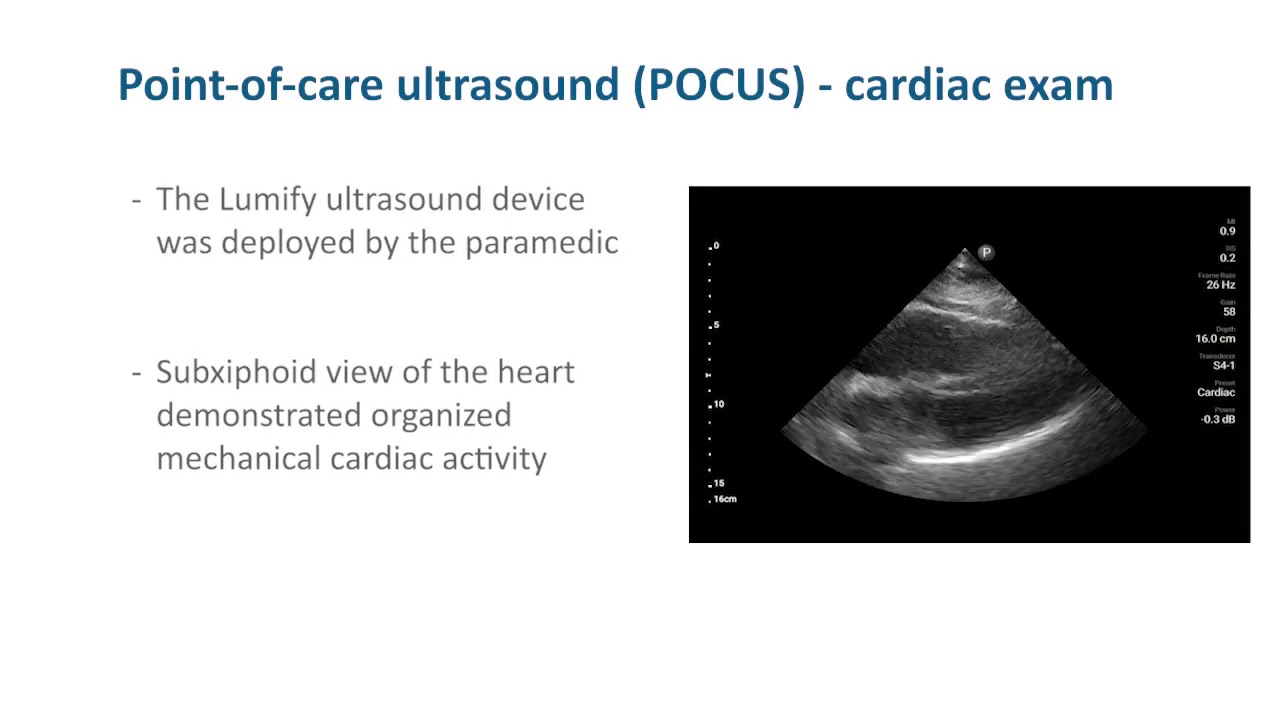 Philips Lumify Reacts case study: Pre-hospiatl cardiac ultrasound in an ...