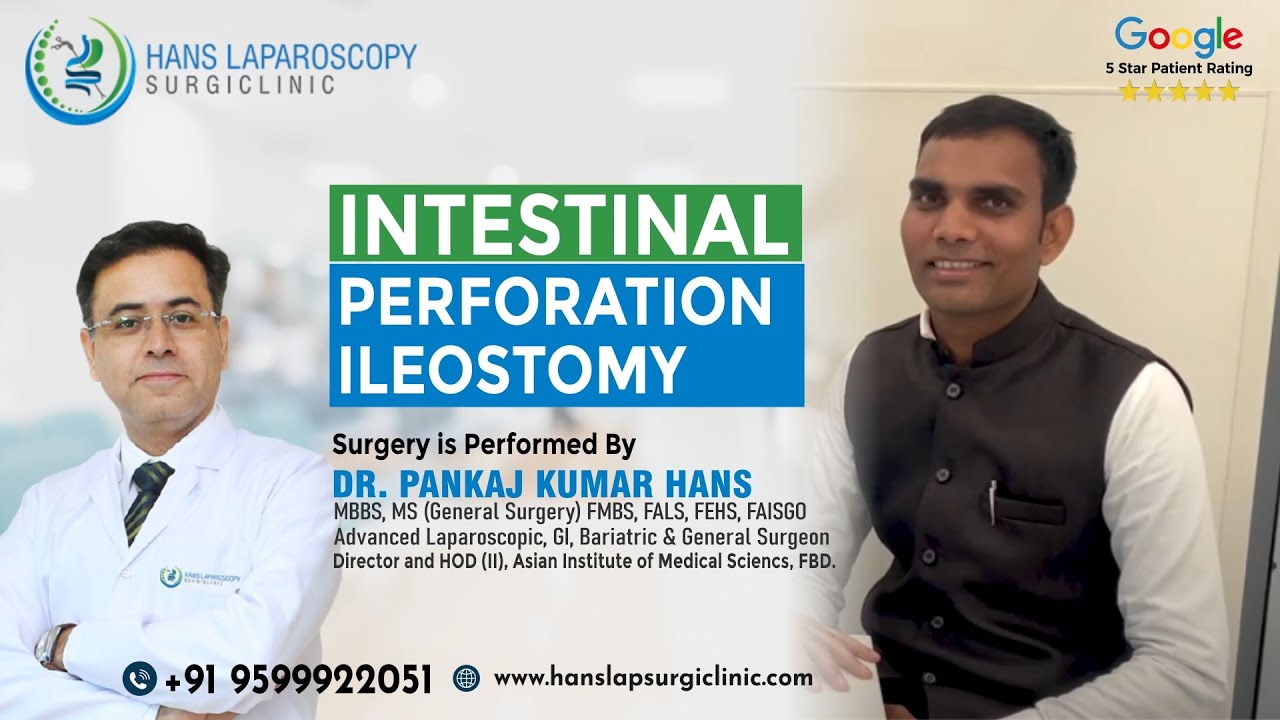 Intestinal Perforation Ileostomy Surgery | Happy Patient | Best ...