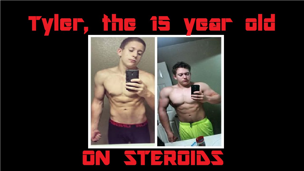 Bignattydaddy, the 15 year old steroid user... - YouTube