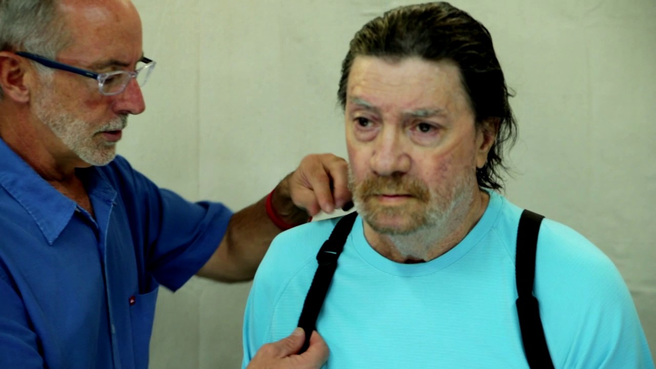 What is Shoulder Subluxation and How Does the GivMohr Sling Help - YouTube